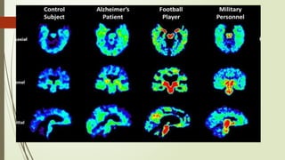 Brain Mapping Test; A psychology and Forensic Perspective | PPTX
