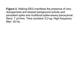 Brain metabolism, eeg, 2012 case study from madrid spain | PPT