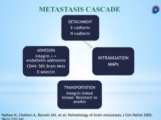Brain metastasis - Simplified | PPTX