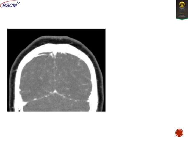 Brain MRI.pptx adalah memberikan gambaran MRI | PPTX