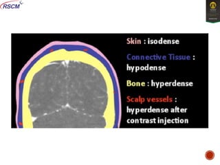 Brain MRI.pptx adalah memberikan gambaran MRI | PPTX