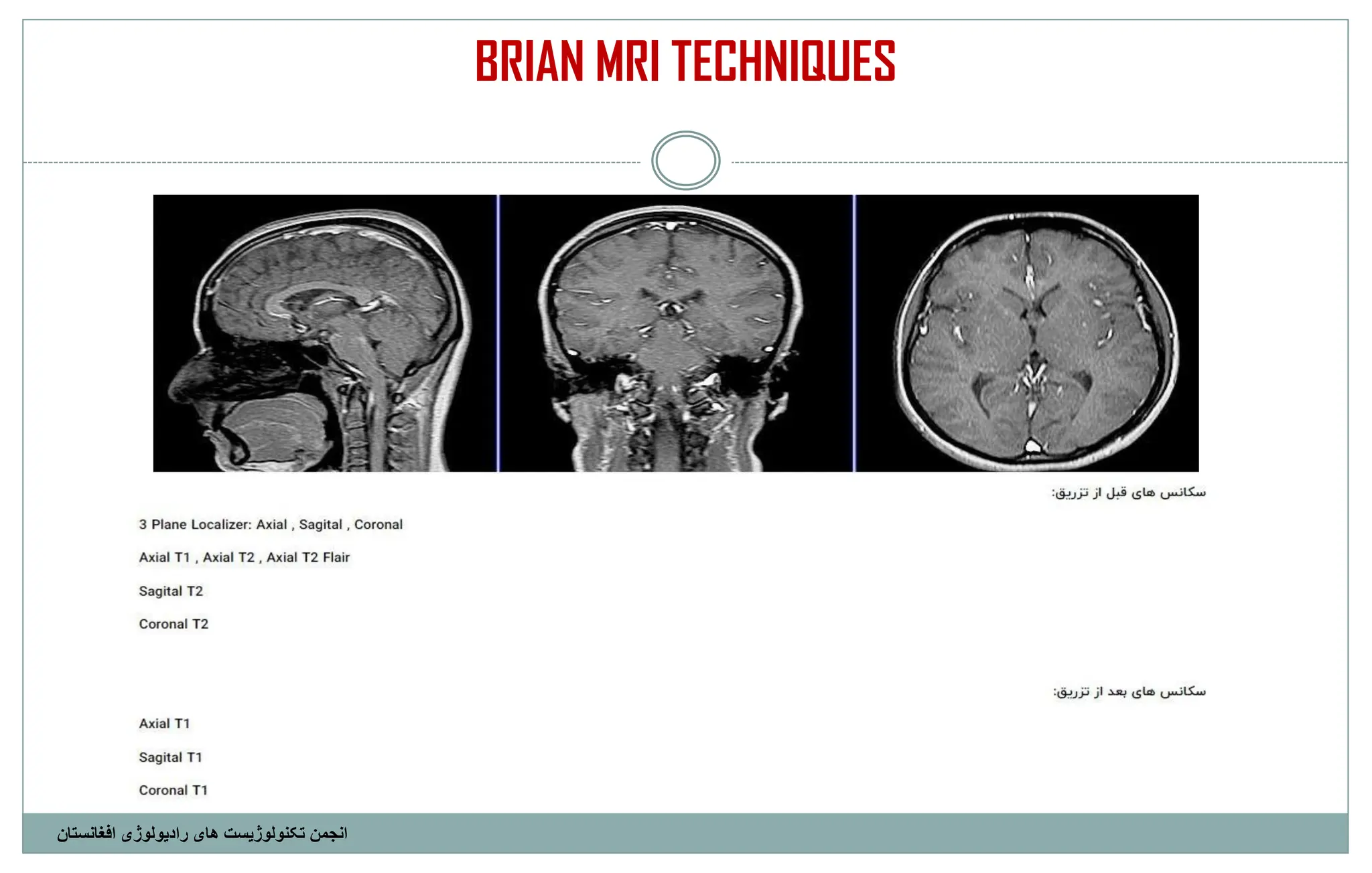 brain mri.pdf of Afghan Society of Radiology Technologist | PDF