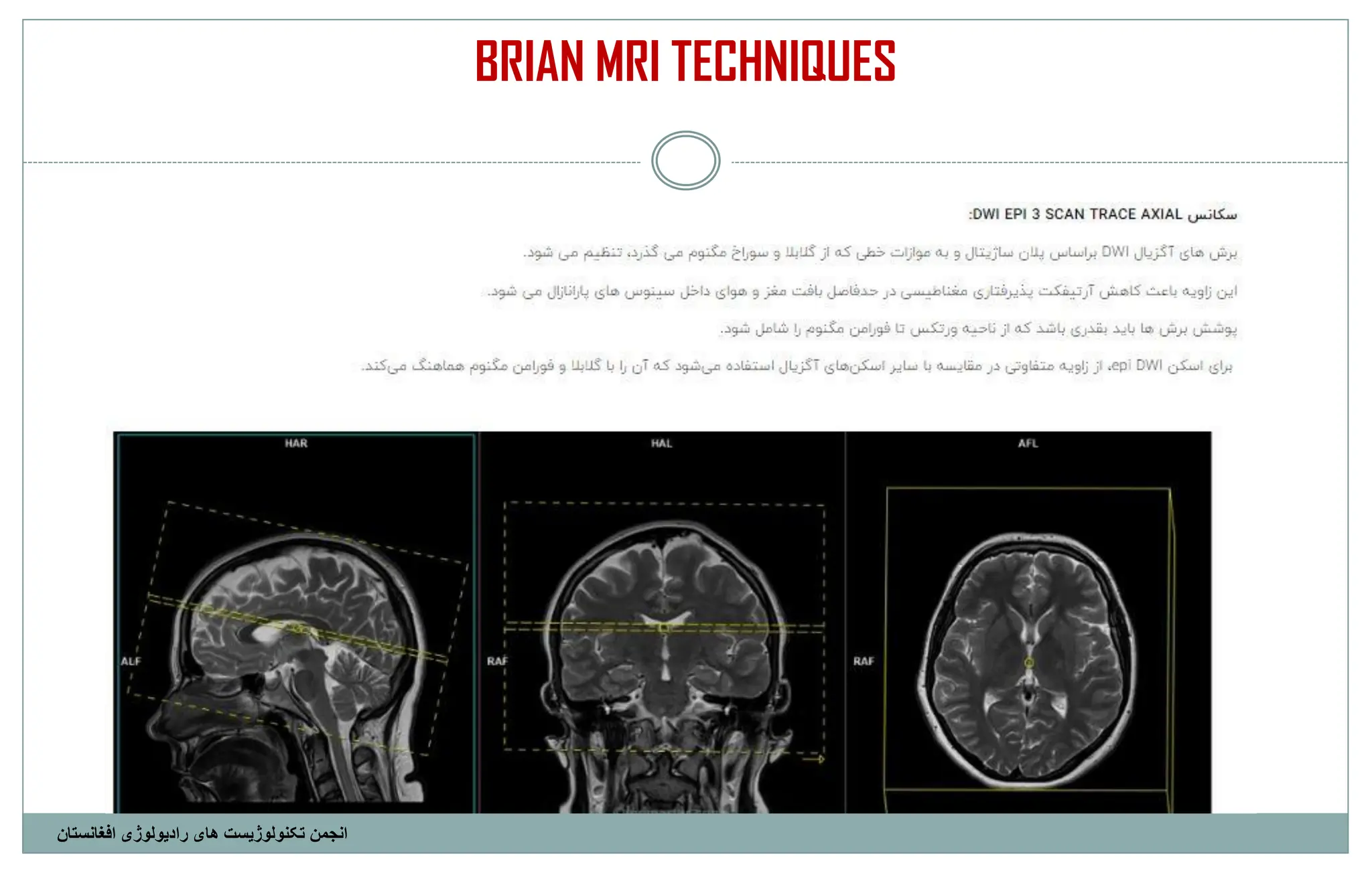 brain mri.pdf of Afghan Society of Radiology Technologist | PDF