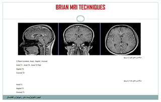 brain mri.pdf of Afghan Society of Radiology Technologist | PDF