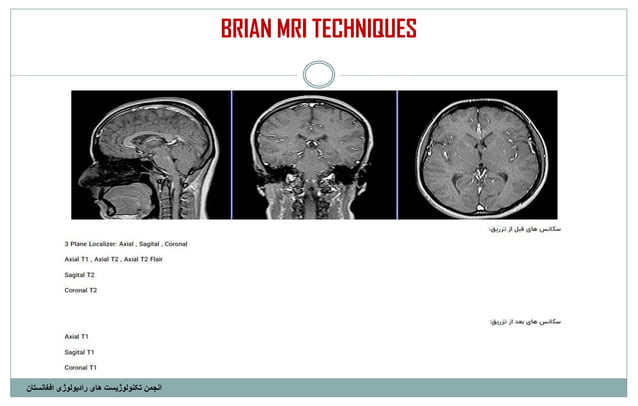 brain mri.pdf of Afghan Society of Radiology Technologist | PDF