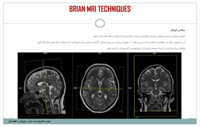 brain mri.pdf of Afghan Society of Radiology Technologist | PDF