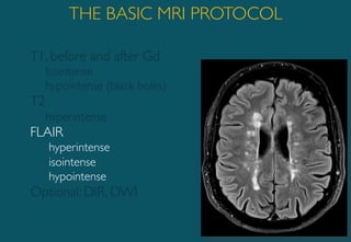 Brain MRI biomarkers for improved follow up of people with Multiple ...