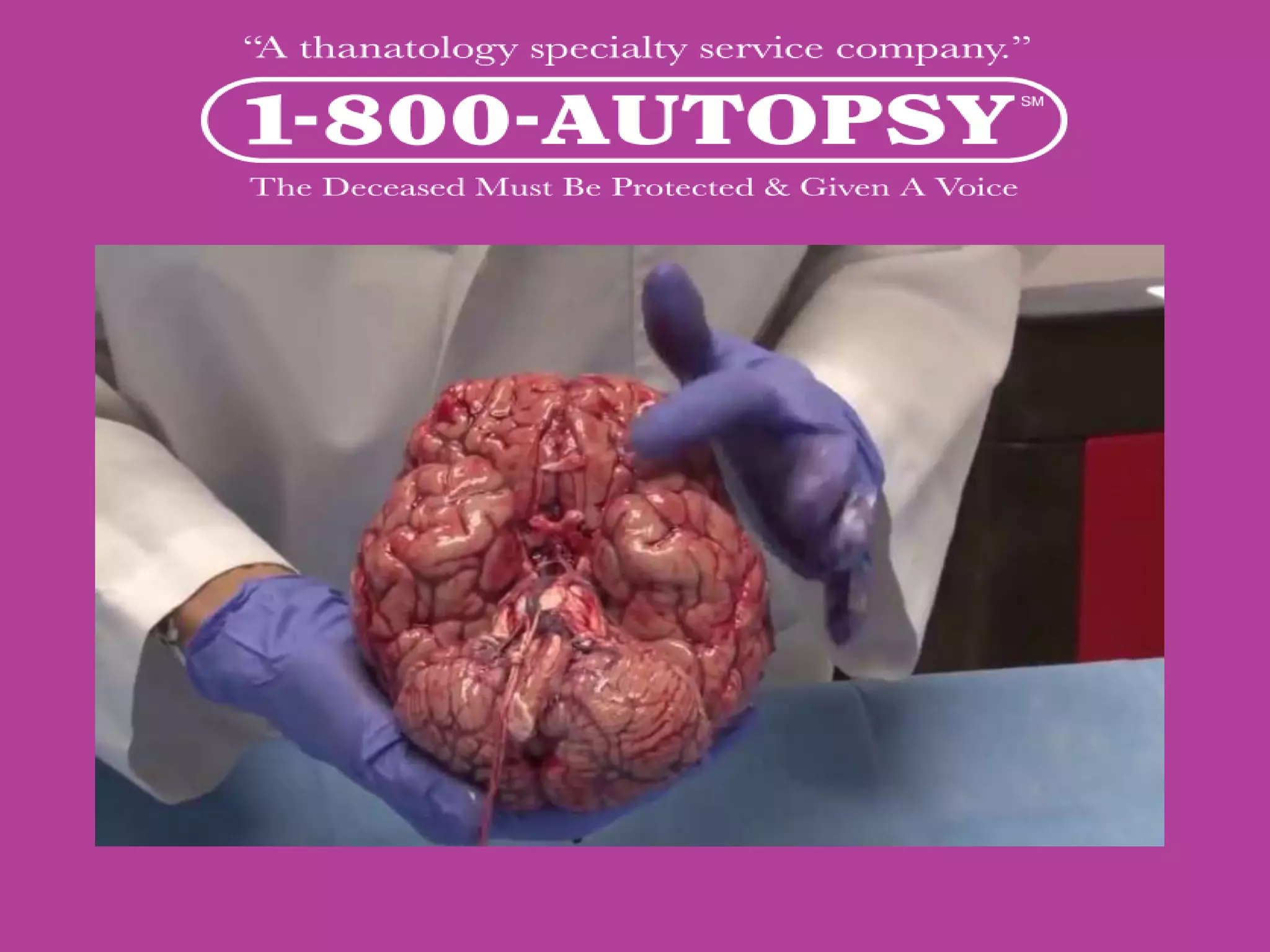 Brain only autopsy company | PPTX