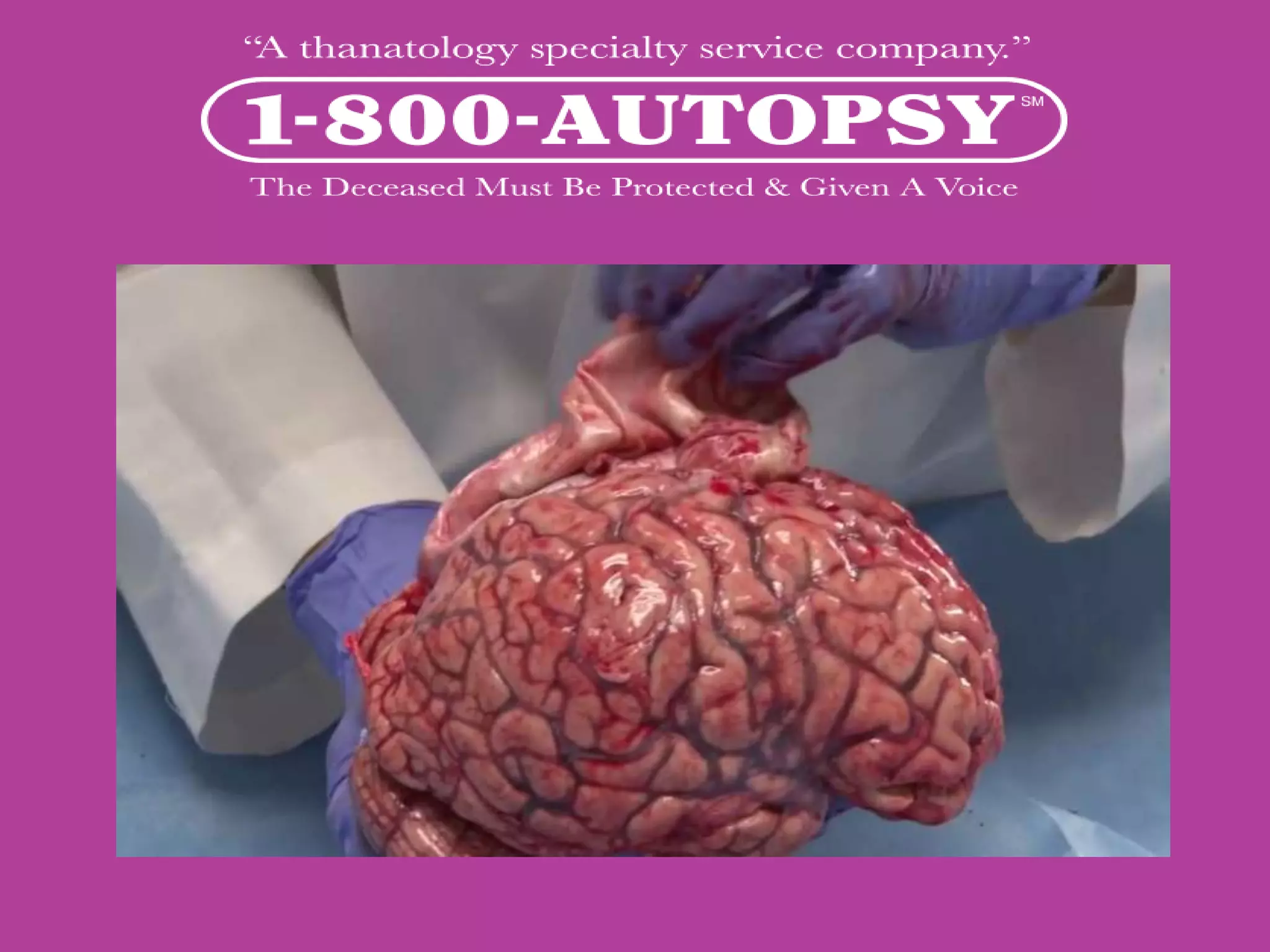 Brain only autopsy company | PPT