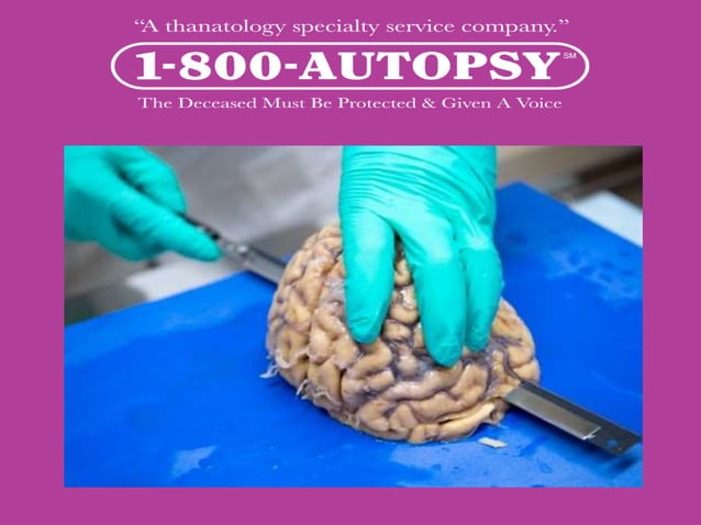 Brain only autopsy company | PPT
