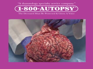 Brain only autopsy company | PPT