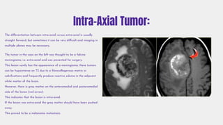 brain pathologies understanding brain diseases | PDF