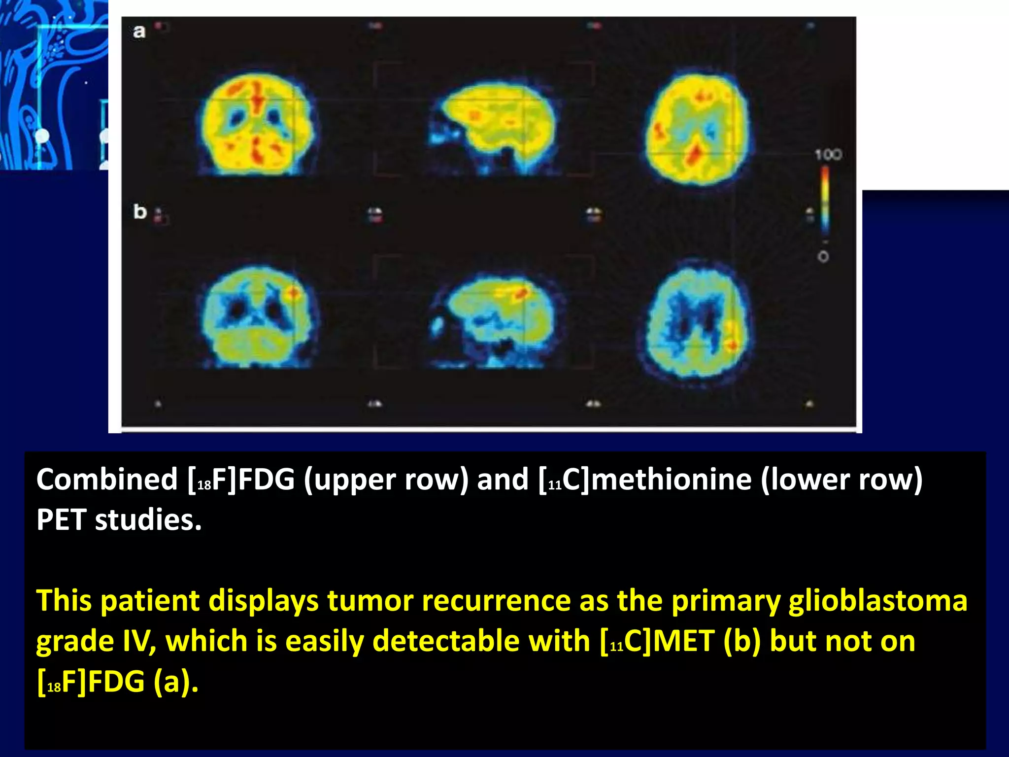 Brain PET imaging | PPTX