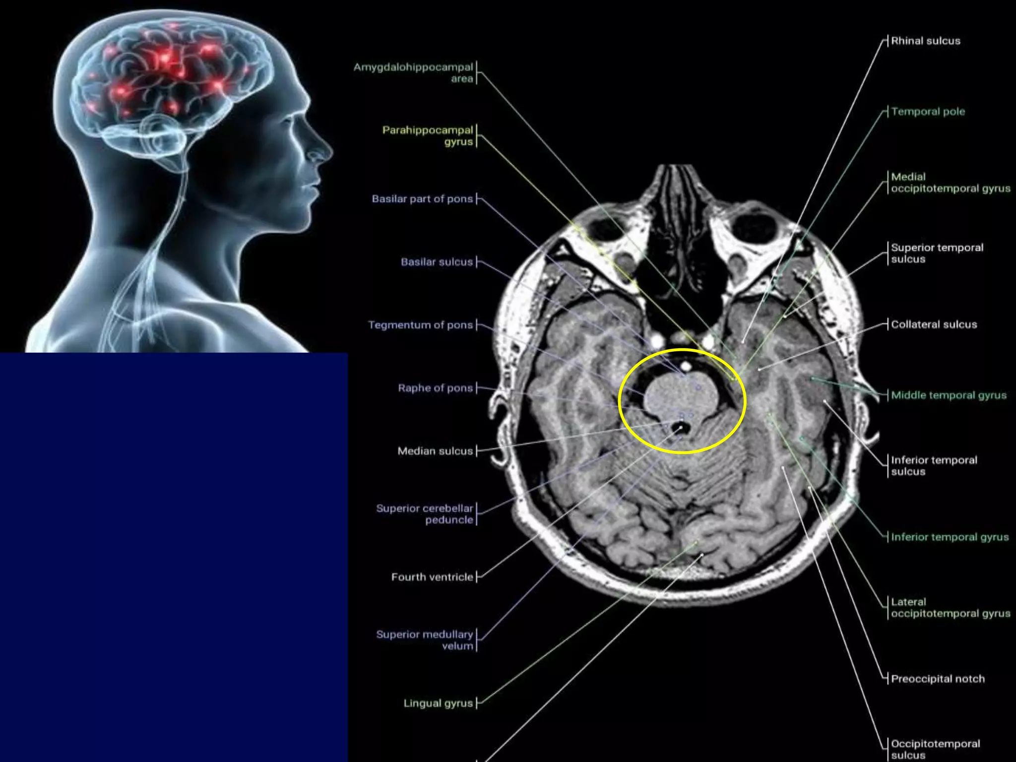 Brain PET imaging | PPTX
