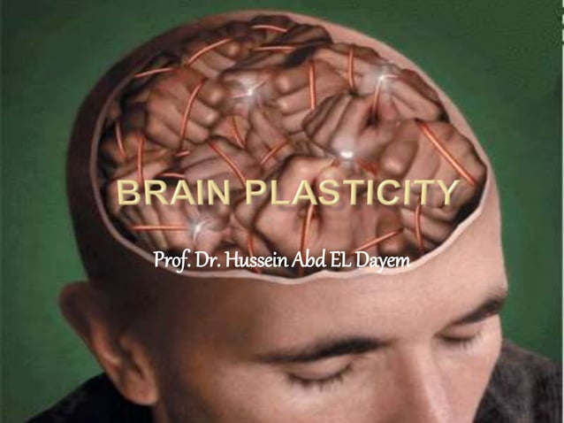 Brain plasticity | PPT