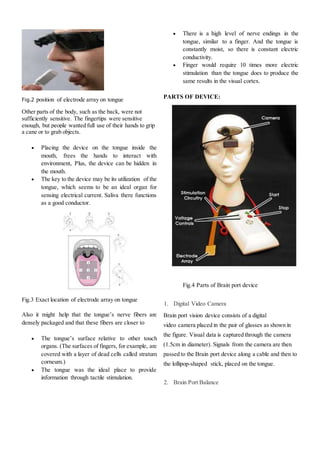 Brain port device | DOCX