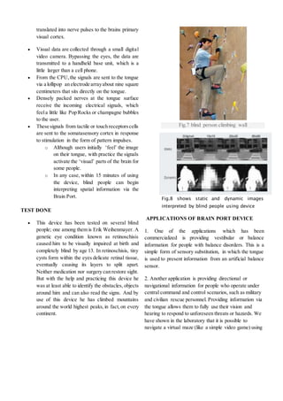 Brain port device | DOCX