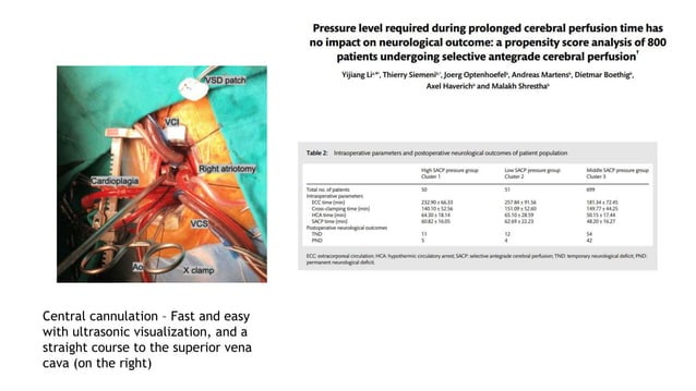Brain Protection Management – (in Aortic Arch.pptx
