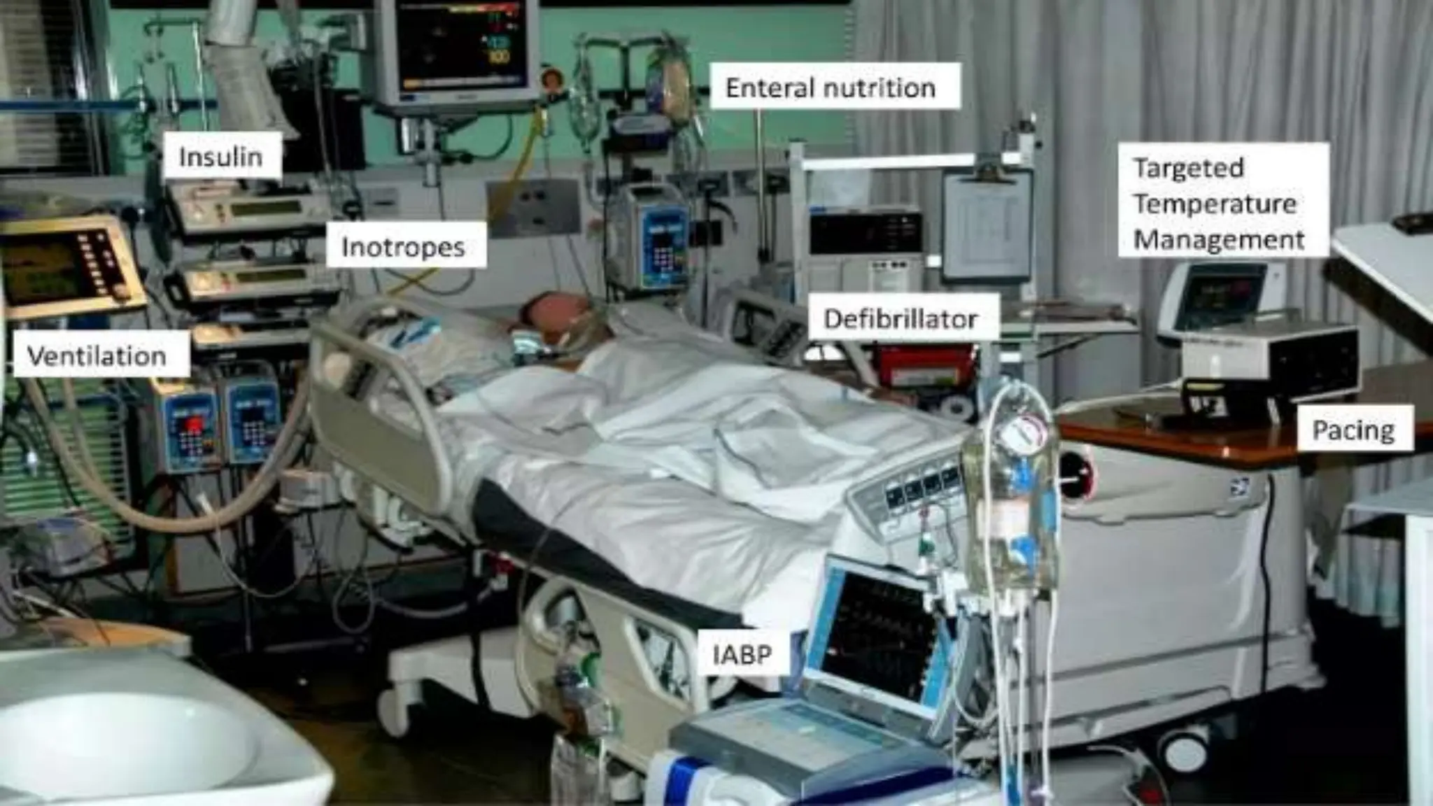 Brain Resuscitation after cardiac arrest | PPT