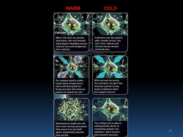 Brain Resuscitation | PDF | First Aid | Injuries