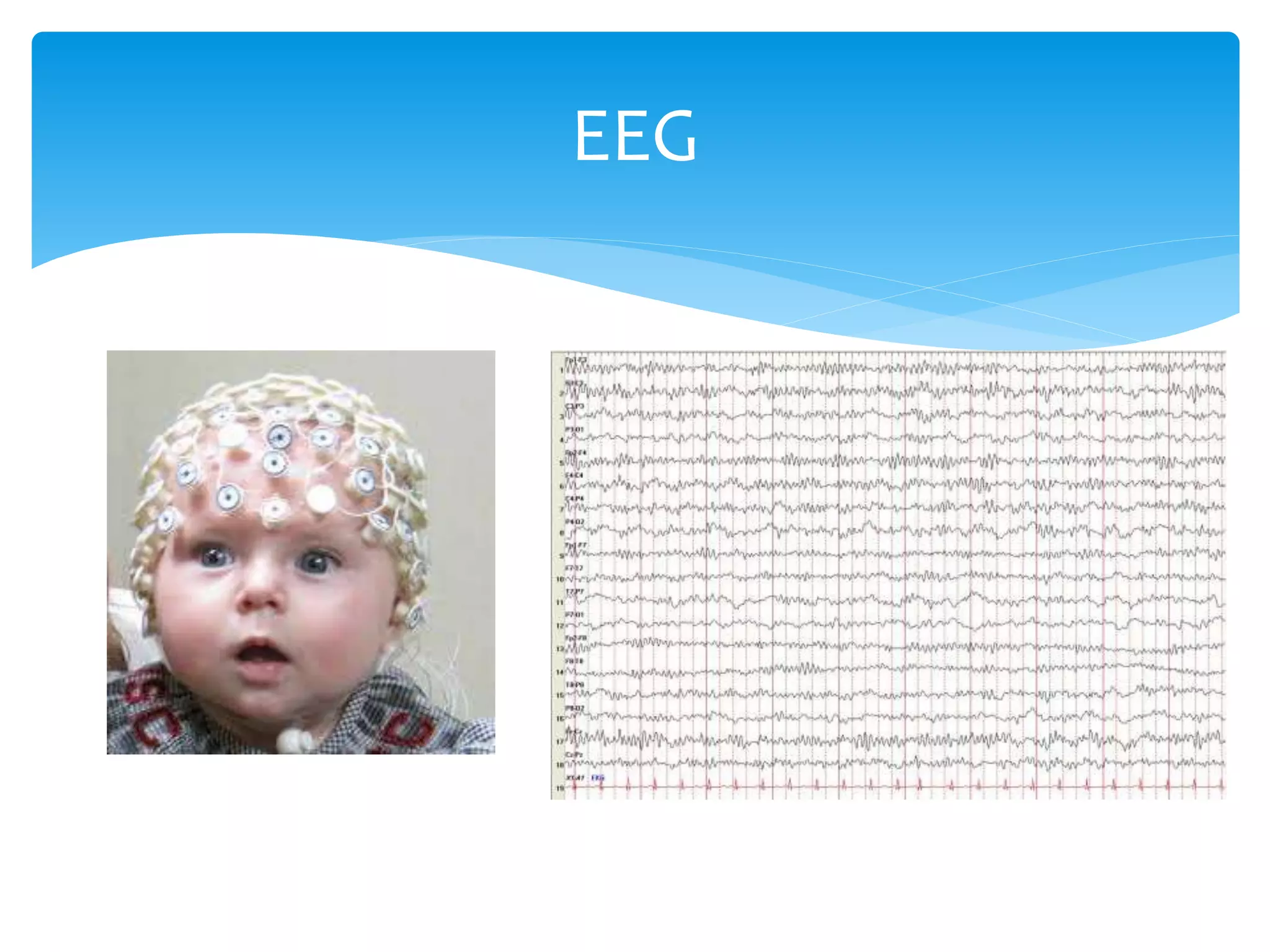 Brain Activity Sensors | PPT