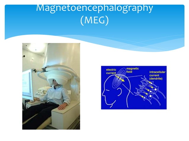Brain Activity Sensors | PPT
