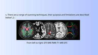 brain scanning.pptx CLINICAL NEUROLOGY PHARMACY PRACTICE | PPT