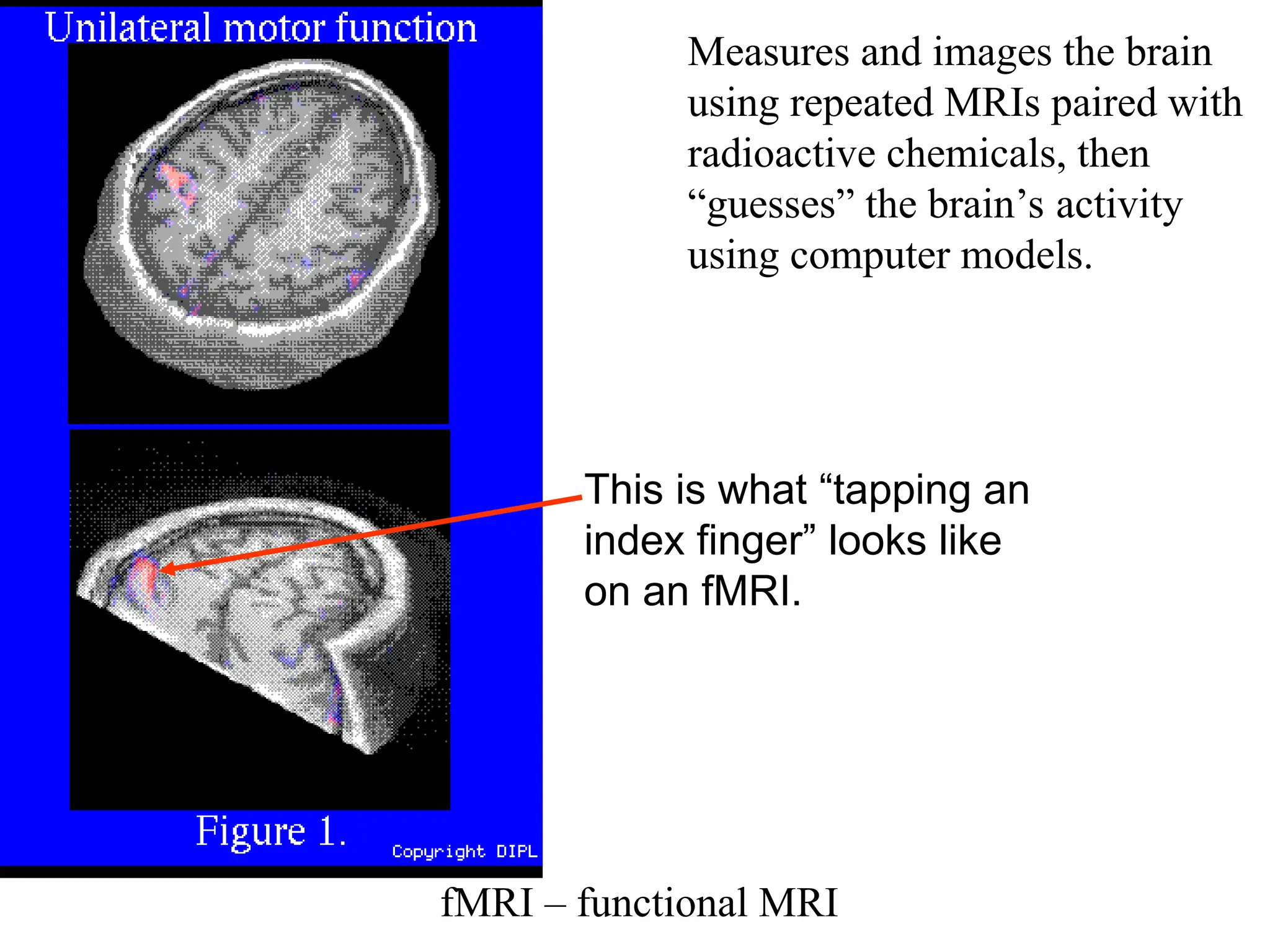 Neuroimaging Scans and Techniques....... | PPT