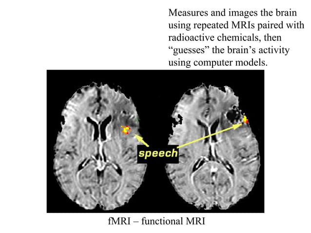 Neuroimaging Scans and Techniques....... | PPT