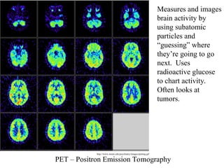 Neuroimaging Scans and Techniques....... | PPT