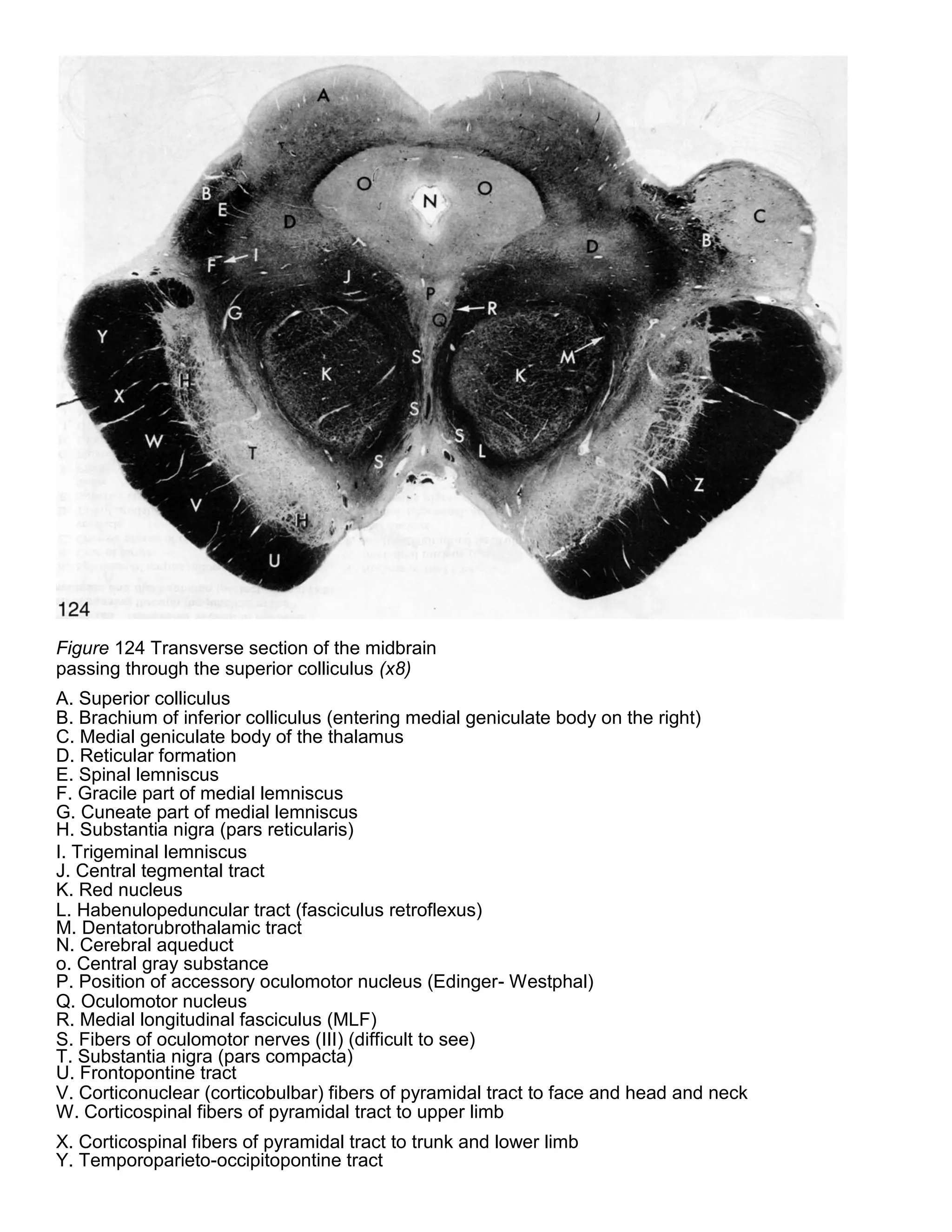 Labelled Brain sections | PDF