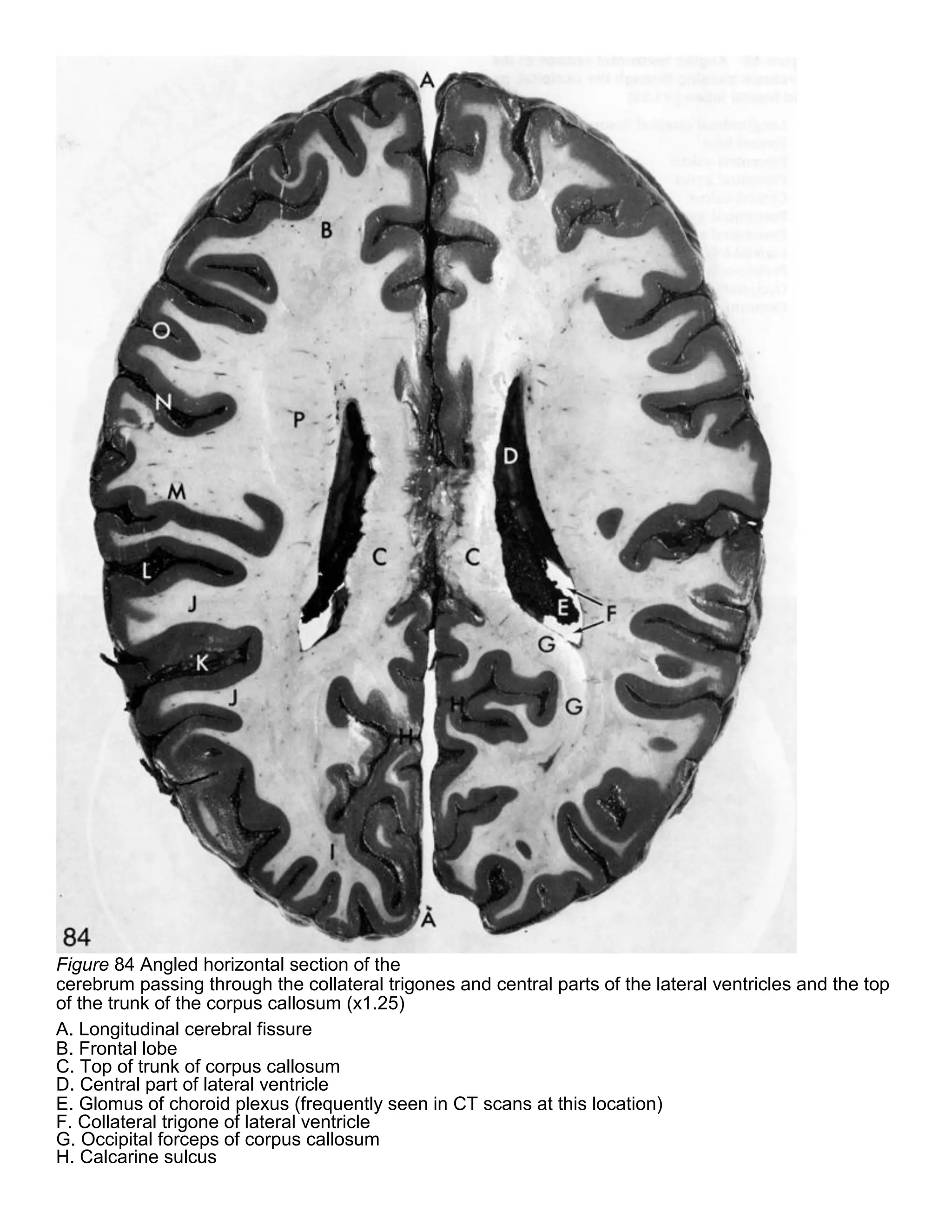 Labelled Brain sections | PDF | Brain and Nervous System Disorders ...