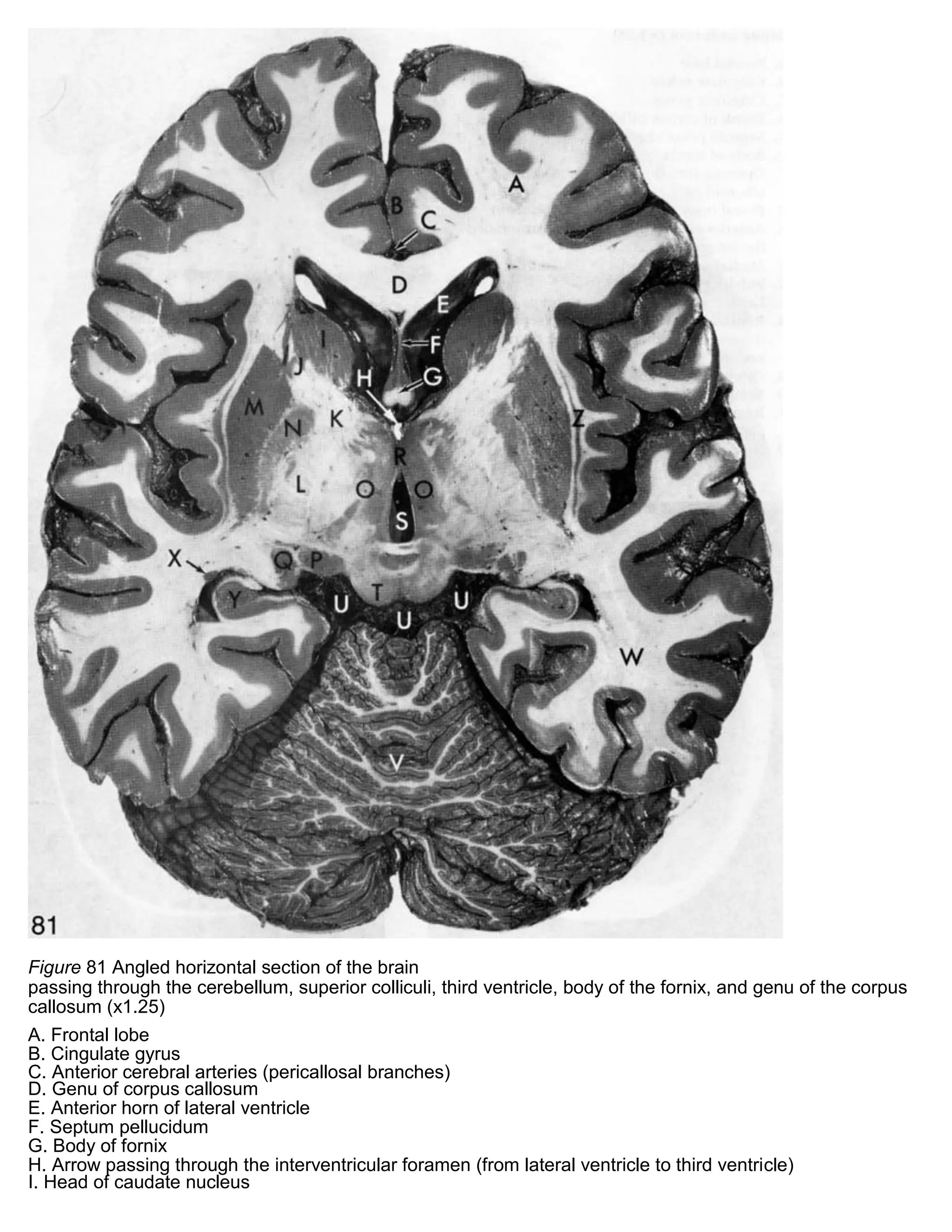 Labelled Brain sections | PDF