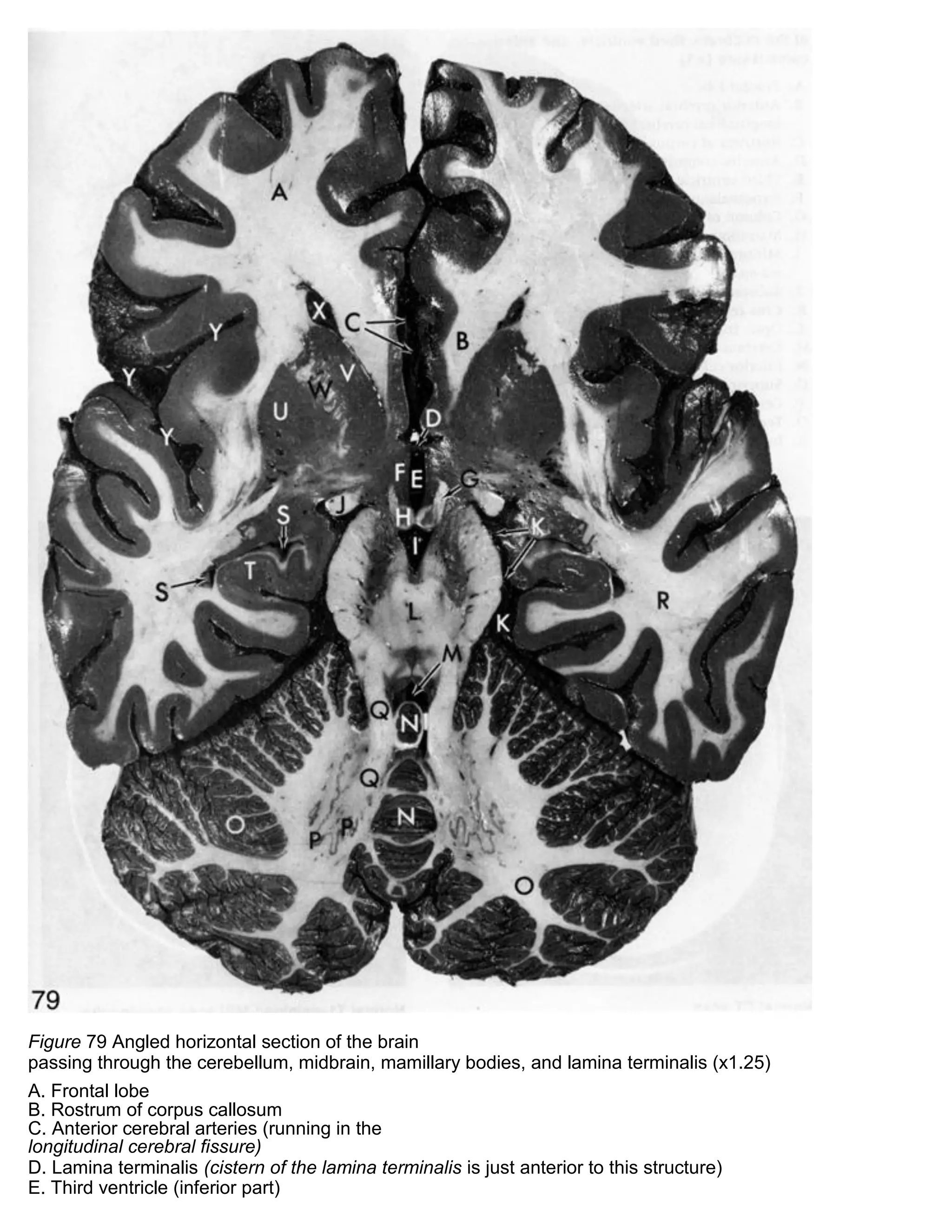 Labelled Brain sections | PDF