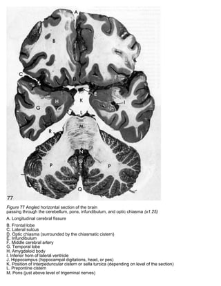 Labelled Brain sections | PDF