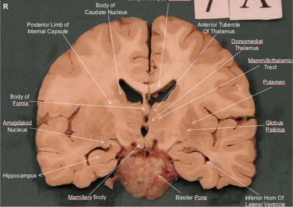 Brain sections - anatomy