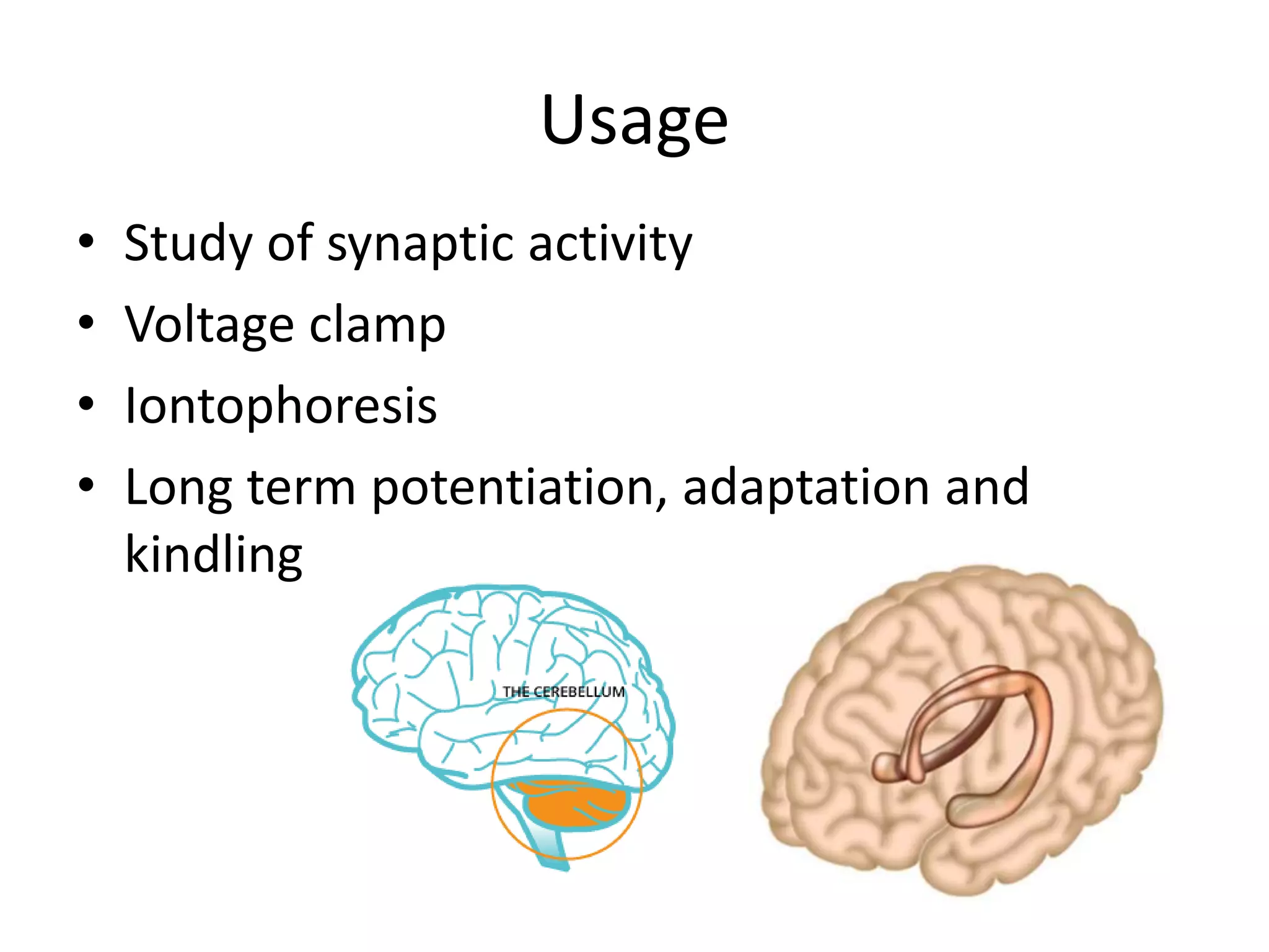 Brain slicing | PPT