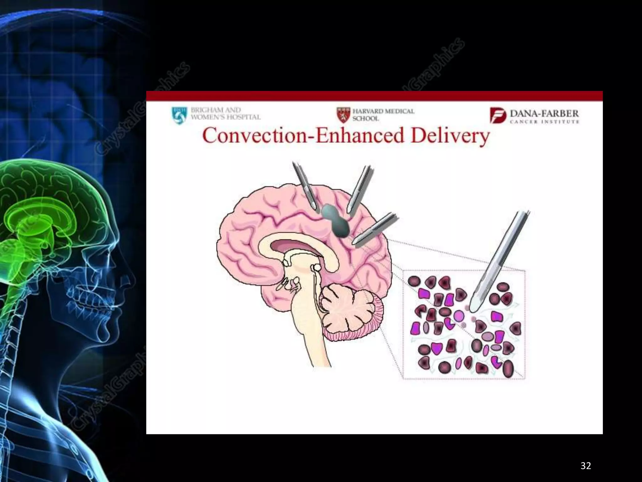 Brain specific delivery | PPTX
