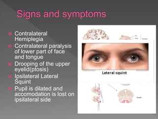 Brain Stem Anatomy for medical presentation | PPT