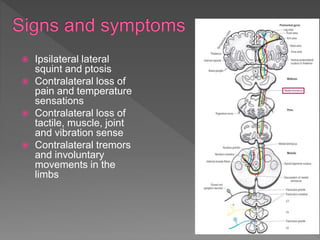 Brain Stem Anatomy for medical presentation | PPT