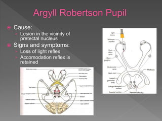 Brain Stem Anatomy for medical presentation | PPTX