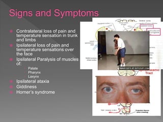 Brain Stem Anatomy for medical presentation | PPT