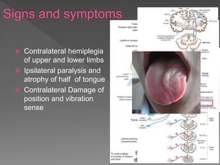 Brain Stem Anatomy for medical presentation | PPT