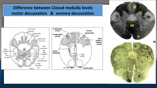 Brainstem - Medulla .pdf histology patha | PDF