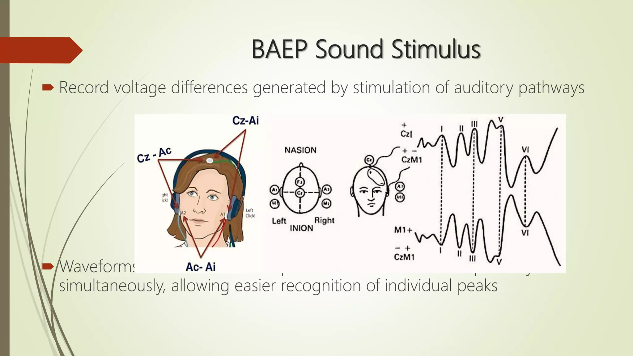Brainstem Auditory Evoked Potentials | PPTX