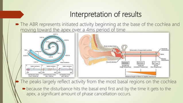 Brainstem Auditory Evoked Potentials | PPTX