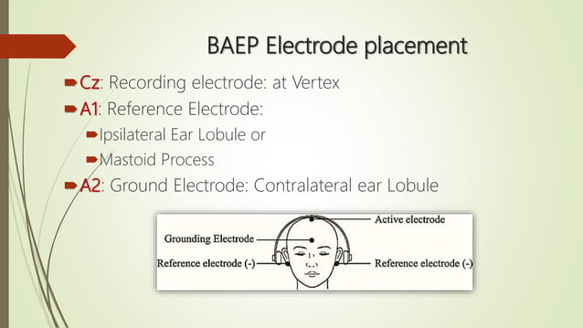 Brainstem Auditory Evoked Potentials | PPTX
