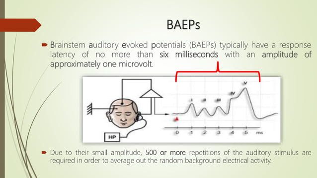 Brainstem Auditory Evoked Potentials | PPT
