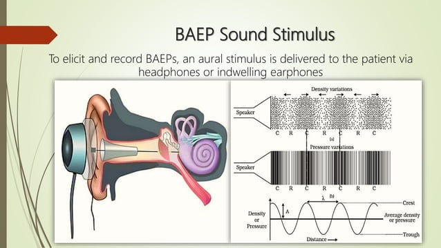Brainstem Auditory Evoked Potentials | PPT