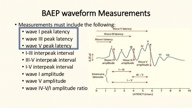 Brainstem Auditory Evoked Potentials Part II